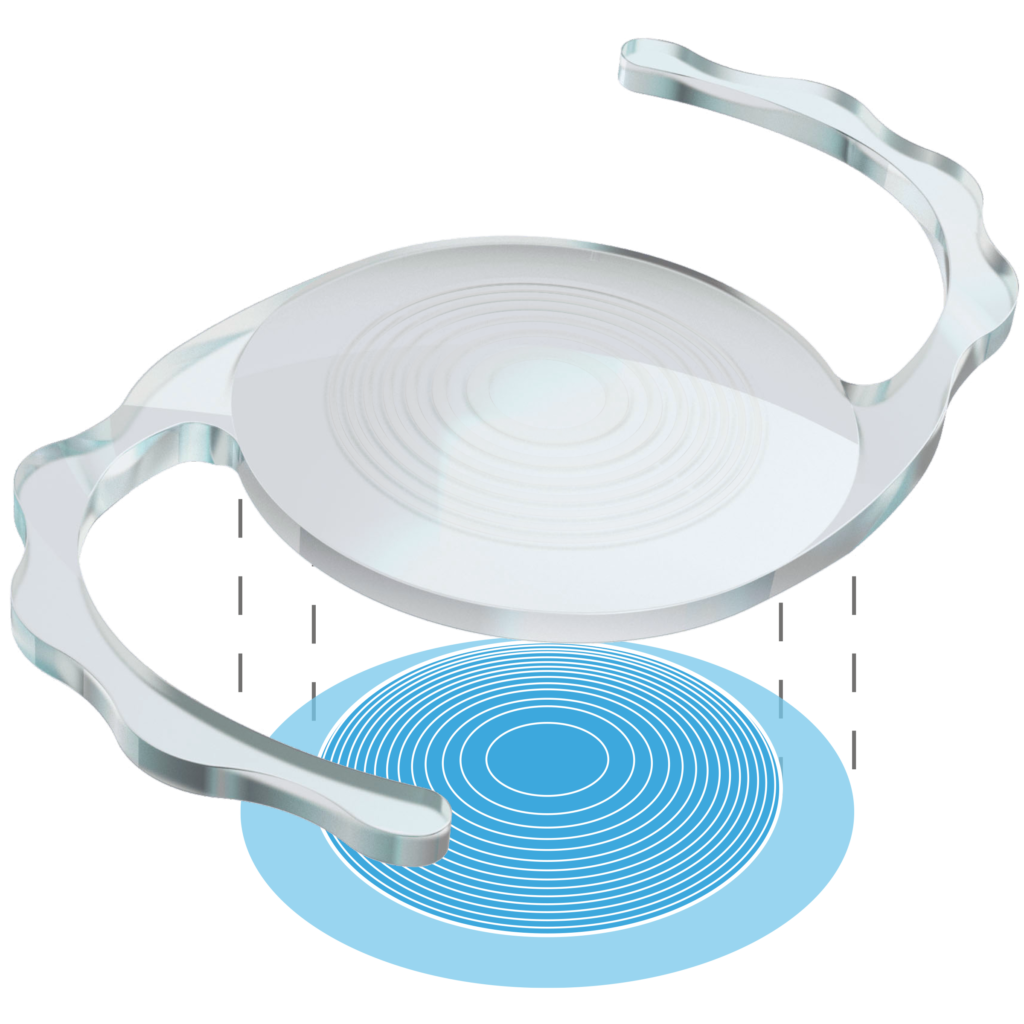 Rayner lentes intraoculares chile - FalcChile